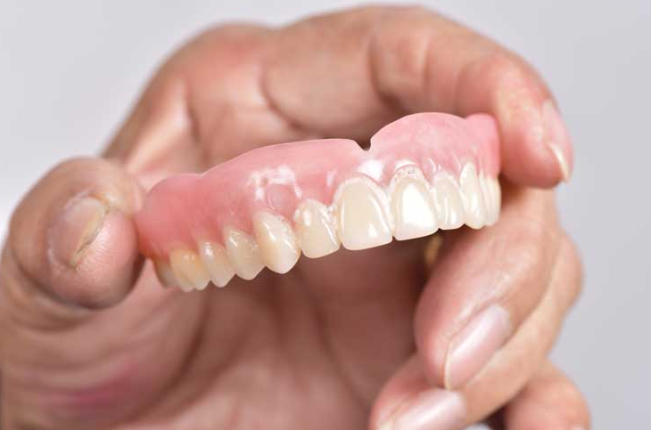 Prótesis Dentales - Prótesis Dentales en Bogotá